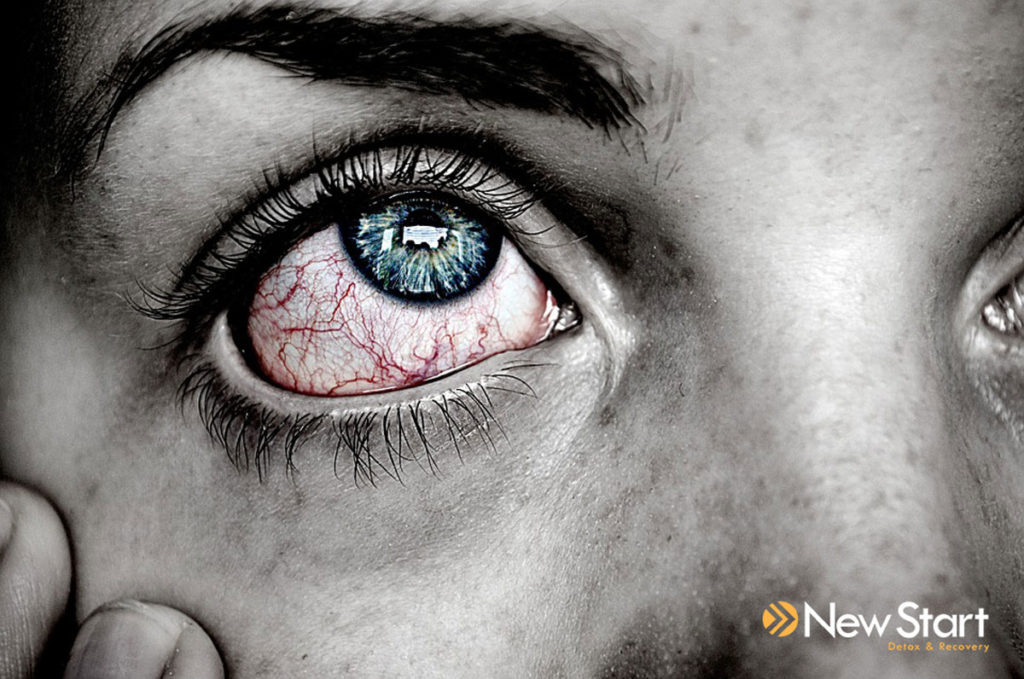 Meth Scabs: The Physical Effects of Methamphetamine Use